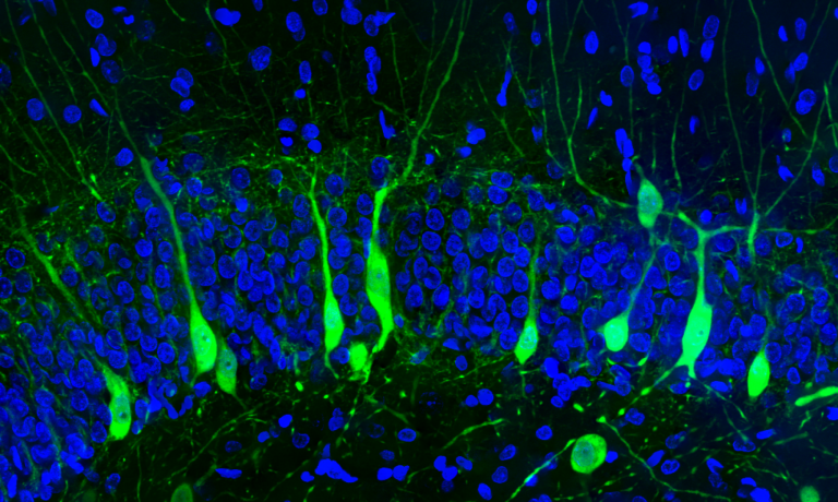 Western Blot with ECL – Christie Lab