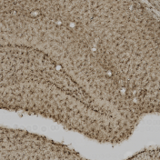 Immunohistochemistry | Christie Lab